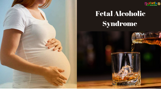 Fetal Alcoholic Syndrome | Symptoms of fetal alocholic syndrome