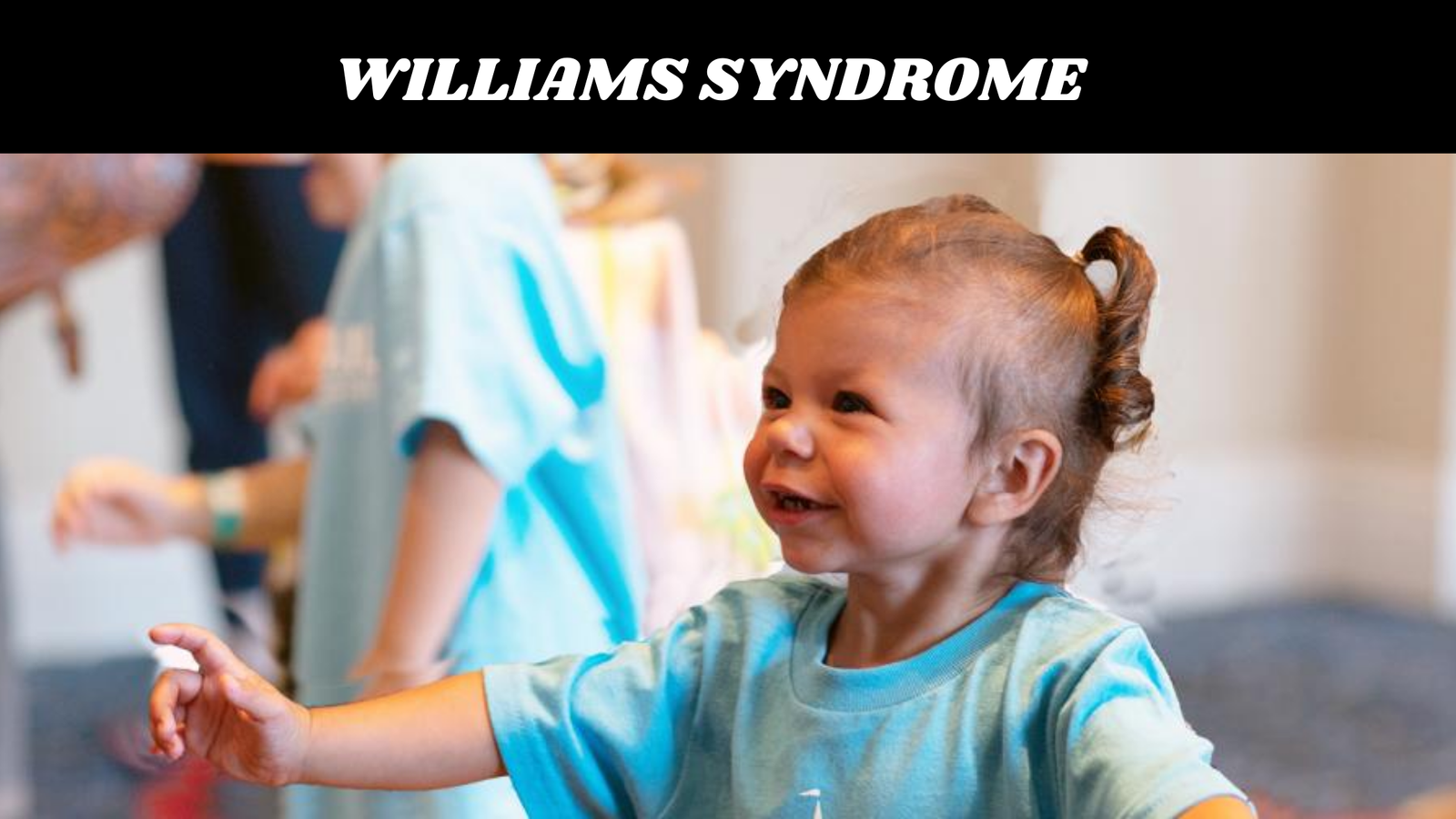 What Is Williams Syndrome Williams Syndrome 40th Gallery – Williams
